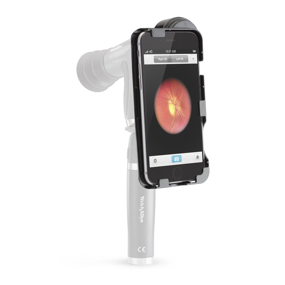 Welch Allyn WELCH ALLYN iEXAMINER 6P (for iPhone 6 Plus and 6s Plus)